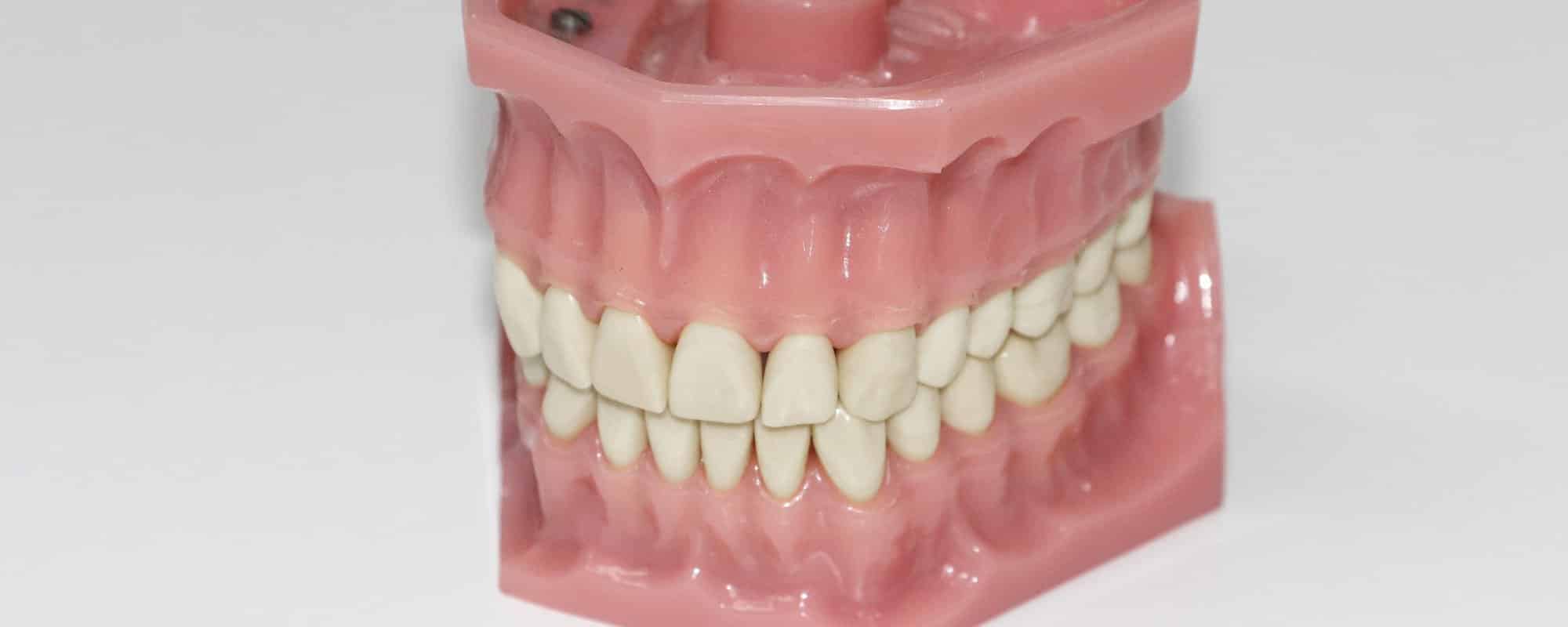 How Your Bite can Harm Mouth Health | Montrose Family Dental